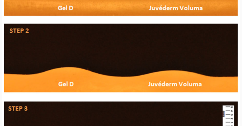 Comparación de la capacidad estimulante de la inyección de ácido ...